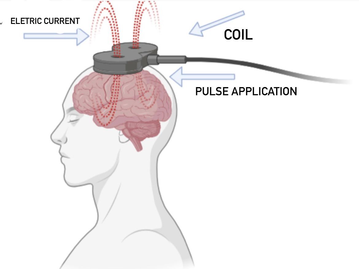 Transcranial Magnetic Stimulation (TMS) | Biomag lab USP RP